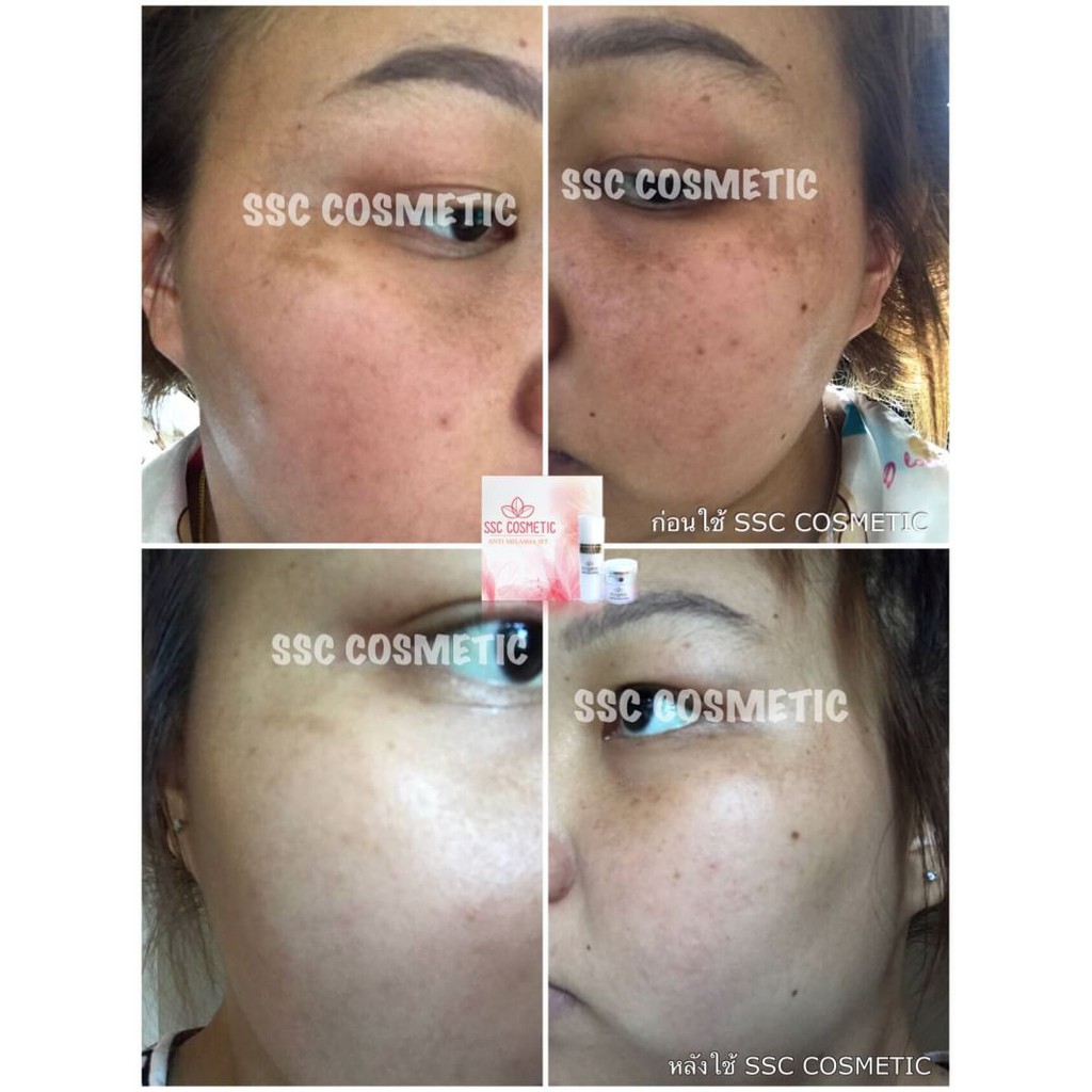 ++มีของแถม++ SSC COSMETIC มีอย.!!!! ลดฝ้า ไว ของแท้????% 2.2 ...