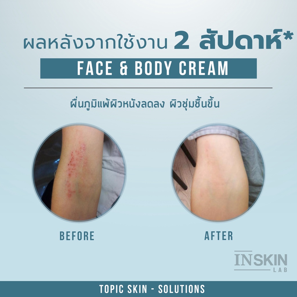 Kamedis TOPIC SKIN Face&Body Cream 150ml เฟเชียล ครีม มอยเจอร์ไรเซอร์ ...