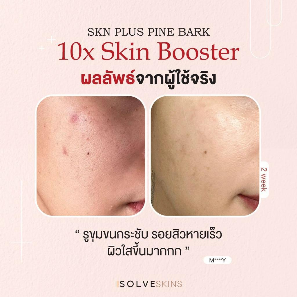 SKN Plus Pine Bark 10X Skin Booster วิตามินกู้ผิวพังกันผิวแก่ ...