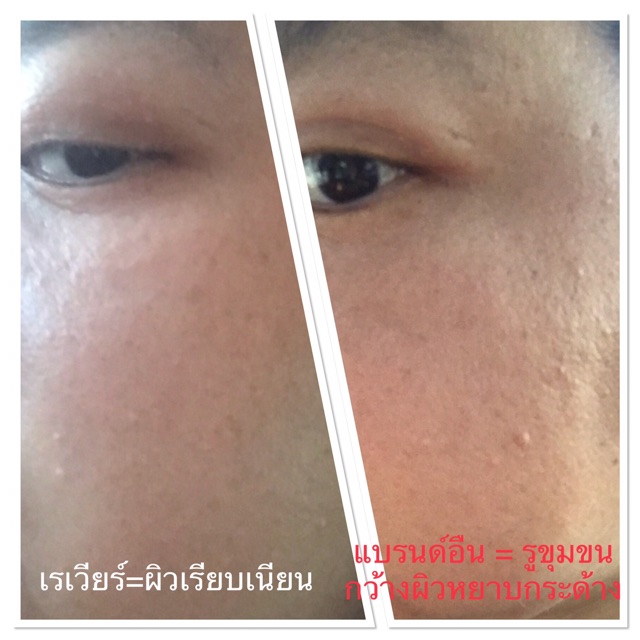 โค้ดส่วนลด 5 Ray Viear Placenta Night Cream ครีมเรเวียร์ ครีมบำรุงสกัด ...