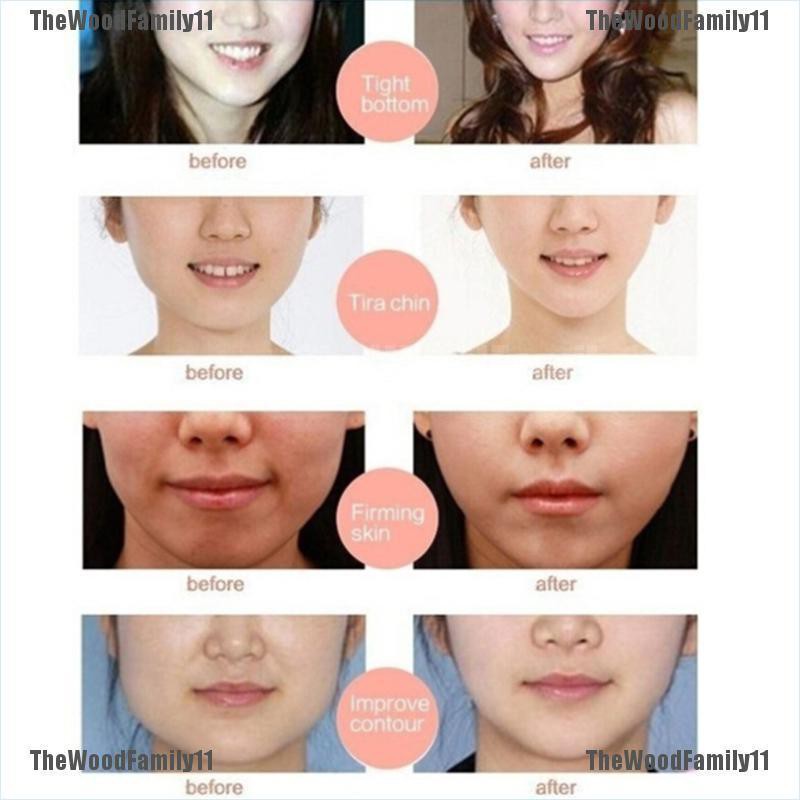 TWF Miracle V-Shaped Slimming Mask Face Care Slimming Mask ...