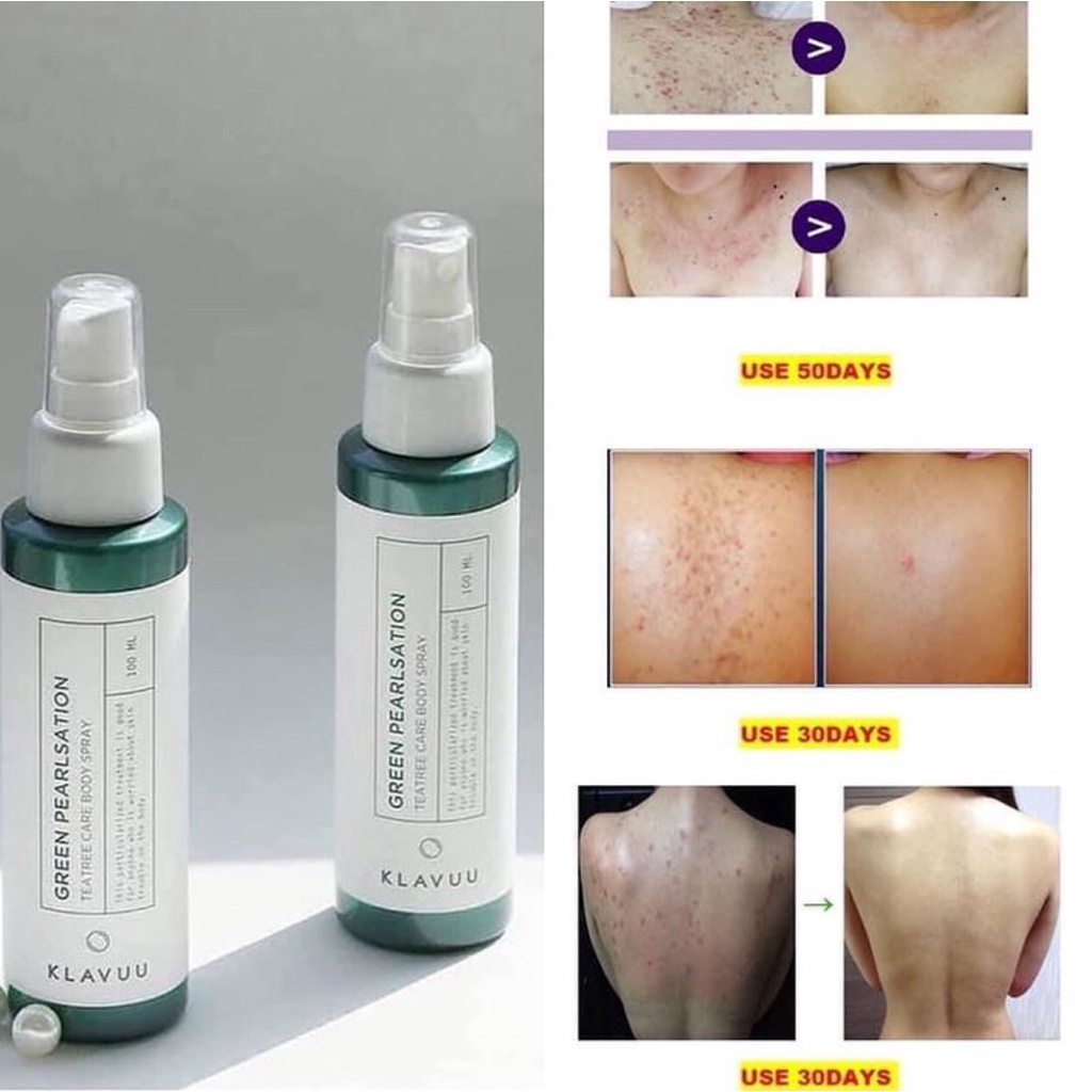 สเปรย์เพื่อผิวกายใสไร้สิว KLAVUU GREEN PEARLSATION Tea tree Care Body ...