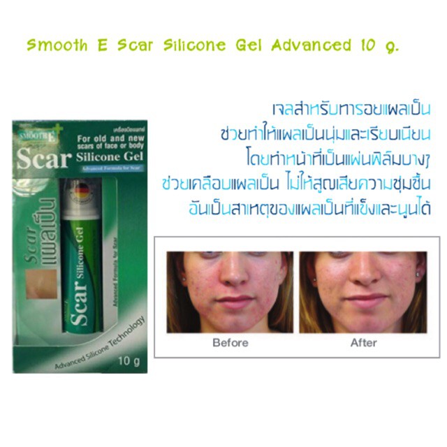 Smooth E Scar Silicone Gel 10g สมูทอี เจลทารอยเเผลเป็น ลดรอยแดงหรือรอย ...