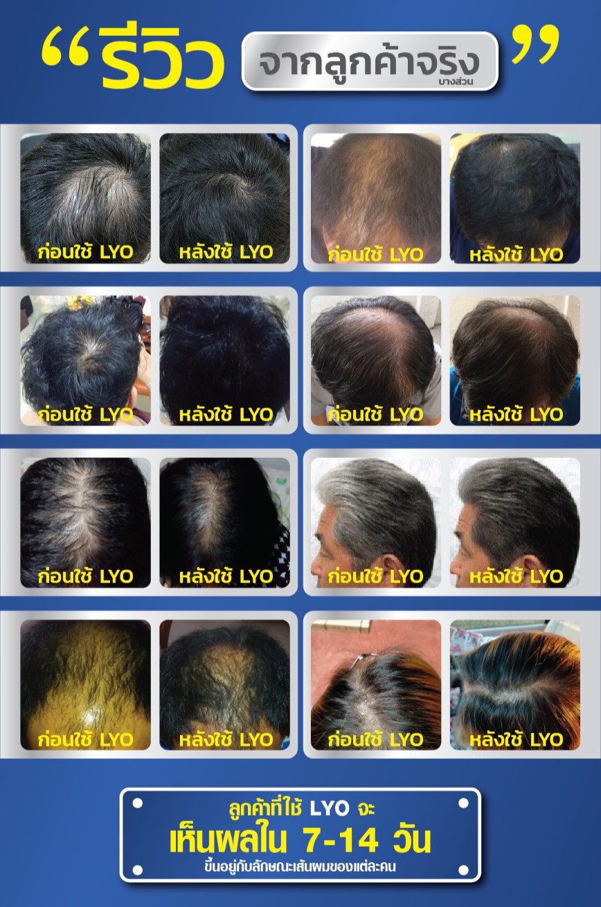 LYO Official, ร้านค้าออนไลน์ | Shopee Thailand