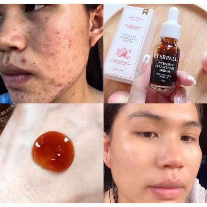 ลดกระหน่ำ‼️เซรั่มสตรอว์ YERPALL ของแท้ 100% - one_td - ThaiPick