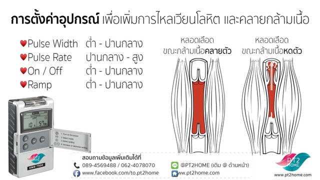 Caretec ii TENs EMS 2 โหมด กายภาพบำบัดทำเองที่บ้าน กระตุ้นไฟฟ้า ...
