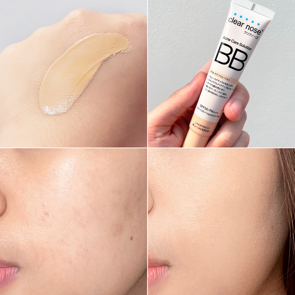โปรแรงบีบีเคลียร์โนส BB Clear Nose BBสิว SPF50PA 30ml ปกปิดดี ไม่อุดตัน ...