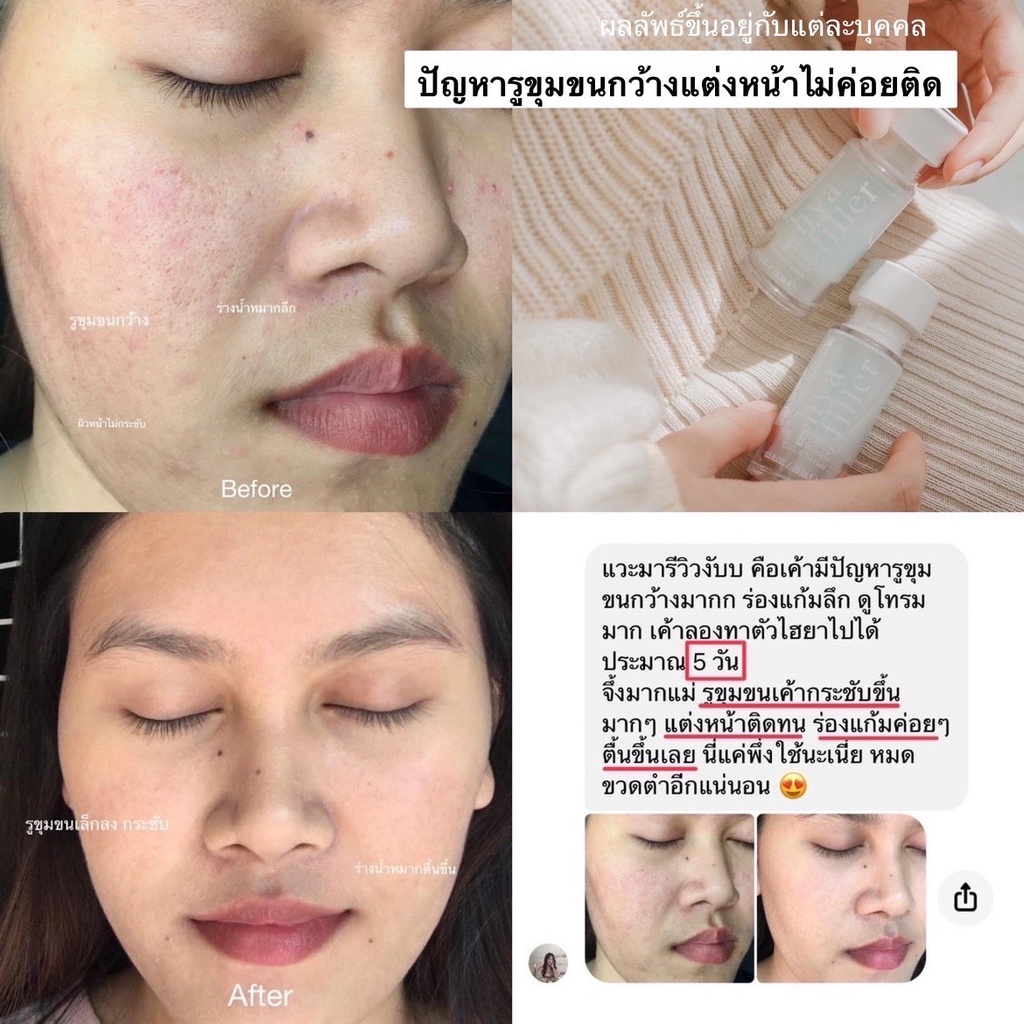 ของแท้ ส่งฟรี️ ฟิลเลอร์แบบทา Haewon Hya Filler แฮวอน ไฮยา ฟิลเลอร์ ขนาด ...