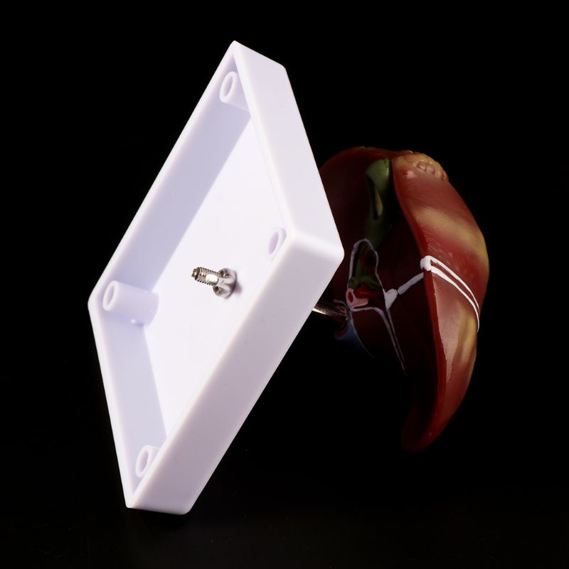 GOO Human Liver Pathological Anatomical Model Anatomy School Medical ...