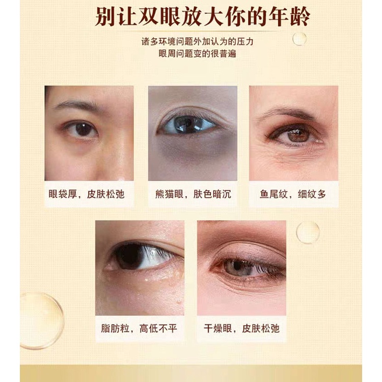 Kangting Rinawale activating Charming Eye Essence ของแท้เคาเตอร์คังติง ...