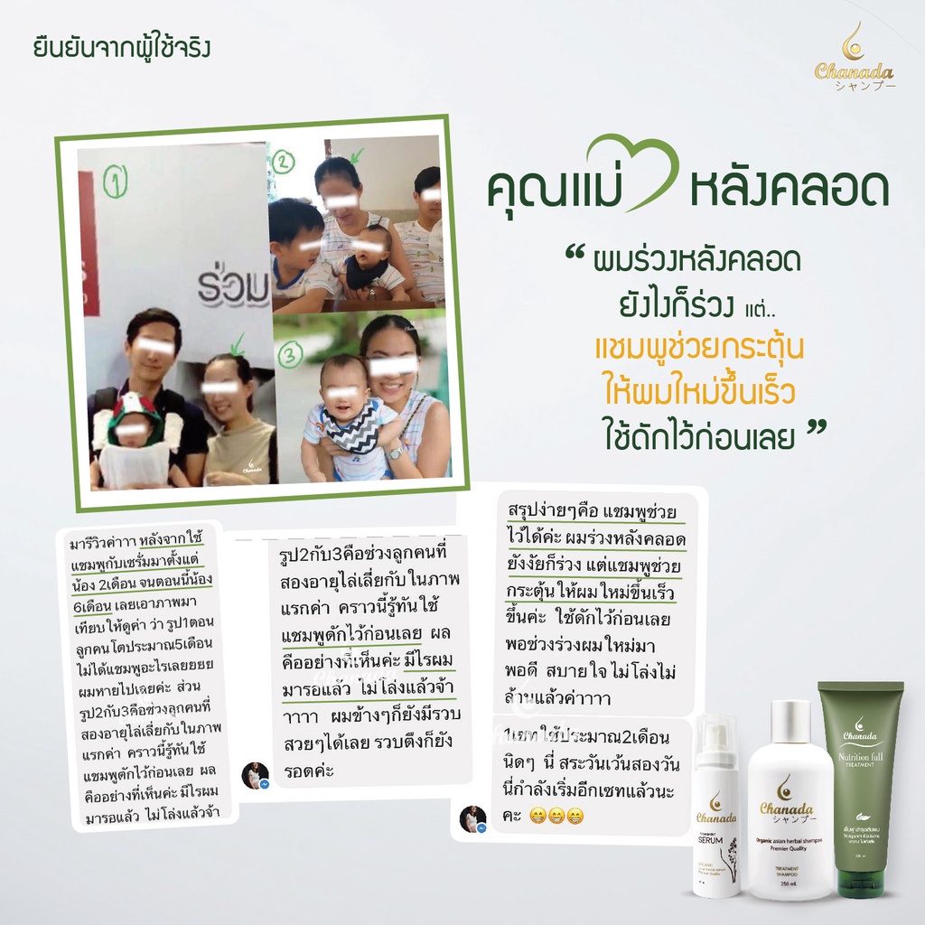 Chanada คุ้มที่สุด️ 2แถม1 ลดผมร่วง สร้างผมหนา ผมนุ่มลื่น เงางาม ส่งฟรี ...