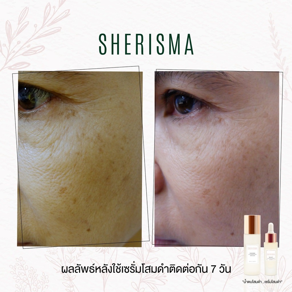 SHERISMA RECOVERY FACIAL SPOT SOLUTION SERUM (เชอร์ริสม่า รีโคฟเวอรี่ ...