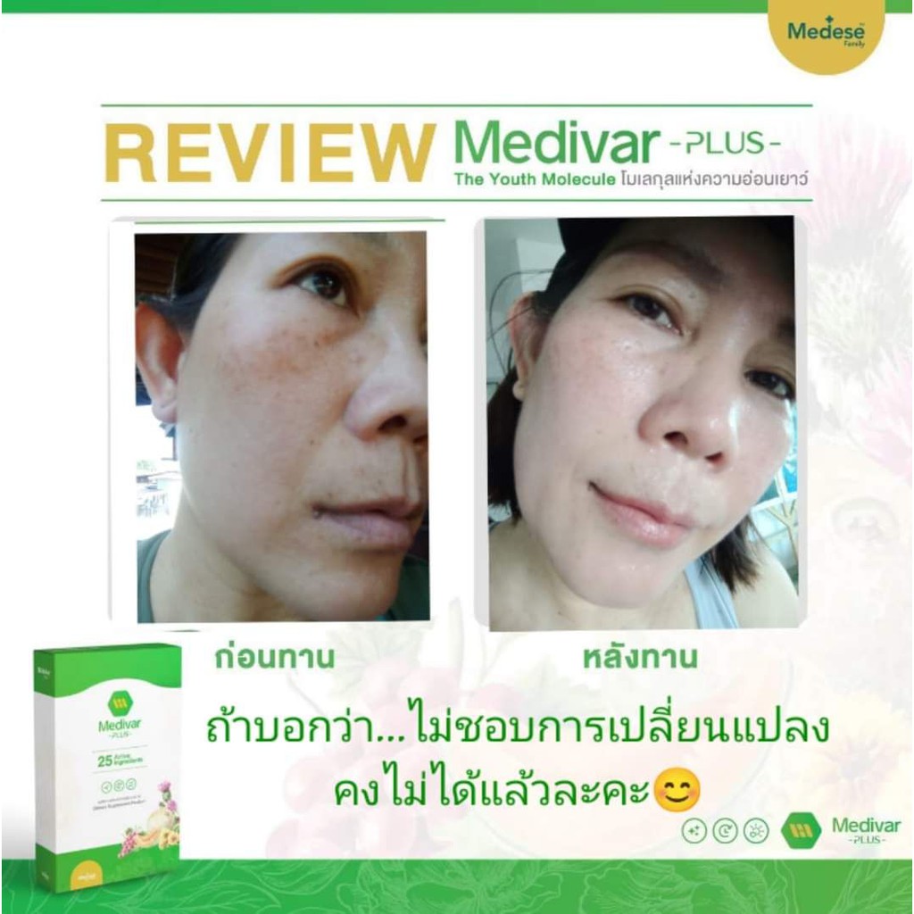 (ออร่าพุ่ง) ????Medivar Plus สูตรใหม่ วิตามิน ต้านริ้วรอยและเสริมสร้างคอลลาเจน ผิวขาวใส ????ราคา ...