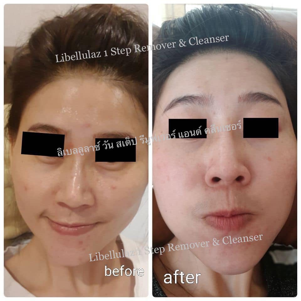 Libellulaz 1 Step Remover Cleanser ( ลิเบลลูลาซ์ วัน สเต็ป รีมูฟเวอร์ ...