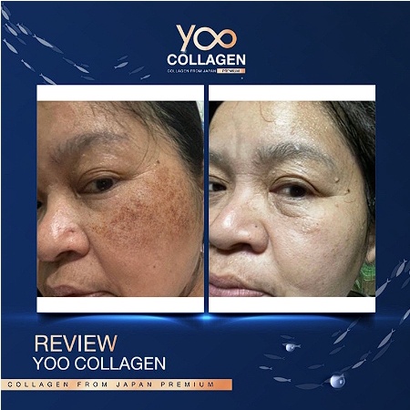 จัดส่งฟรี Yoo collagen ยูคอลลาเจน คอลลาเจนบริสุทธิ คอลลาเจนญี่ปุ่น คอล ...