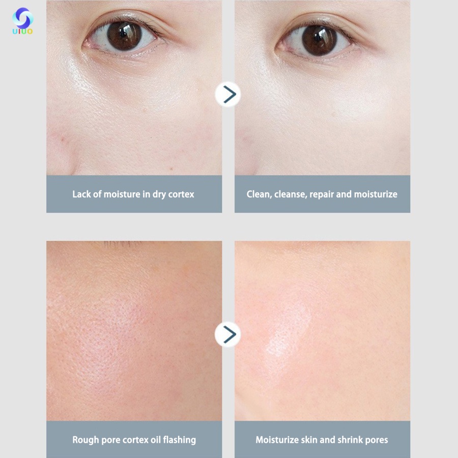 【UIUO】 Snail Essence คลีนเซอร์ทําความสะอาดผิวหน้า ให้ความชุ่มชื้น 100 ...