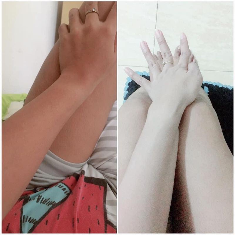 หัวเชื้อคลีนิค ขนาด 100g. Only clinic พร้อมส่ง ของแท้100 - bbshop_8 - ThaiPick