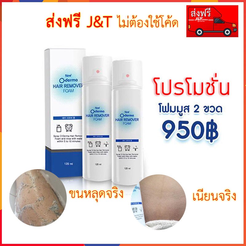 โปรOderma 2 ขวด 950 ส่งฟรี มูสกำจัดขนนำเข้าจากประเทศเกาหลี กำจัดขนรักแร้ กำจัดขนหมออ้อย กำจัดขน ...