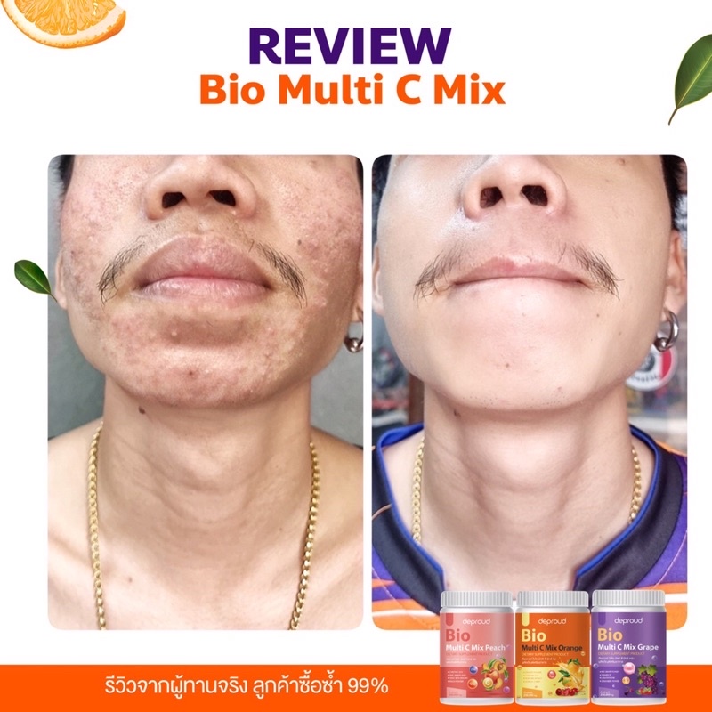 (ส่งฟรีแถมแก้วเชค️) วิตซีสด ลอตใหม่ลุ้นทองในกระปุก️ Deproud Bio Multi C ...