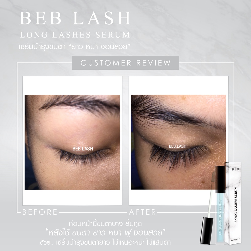 pip Minox 5 เร่งรากผมให้หนา ดกดำ 100เม็ด - poprock789 - ThaiPick