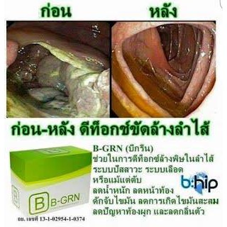 bhip บีกรีน BGRN ดีทอคซ์ ล้างลำไส้ ลดพุง ปลอดภัย 100% ส่งฟรีทั่วไทย ...
