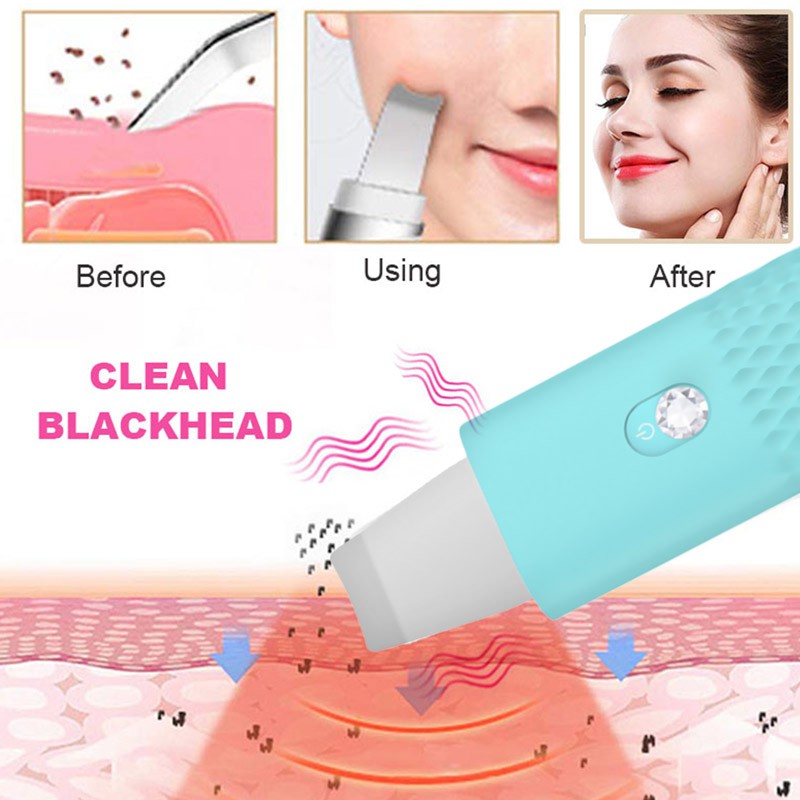 Black Head Cleaner ABS Fast Clean Black Head Cleaner ABS Effective ...