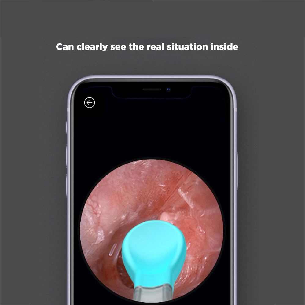 Xiaomi Youpin Bebird M9 Pro Smart กล้องส่องทางไกลความแม่นยําสูง 350 mah ...