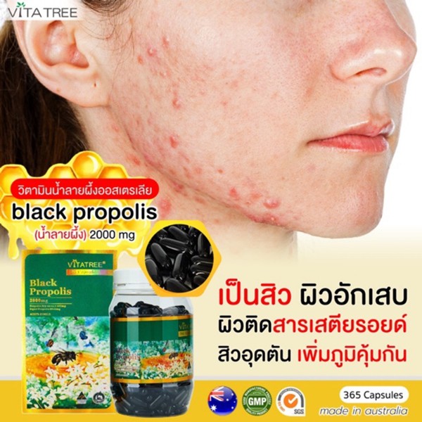 น้ำลายผึ้งดำ Vitatree 2000mg Black Propolis กระปุก 365เม็ด - icosmeticsuk - ThaiPick