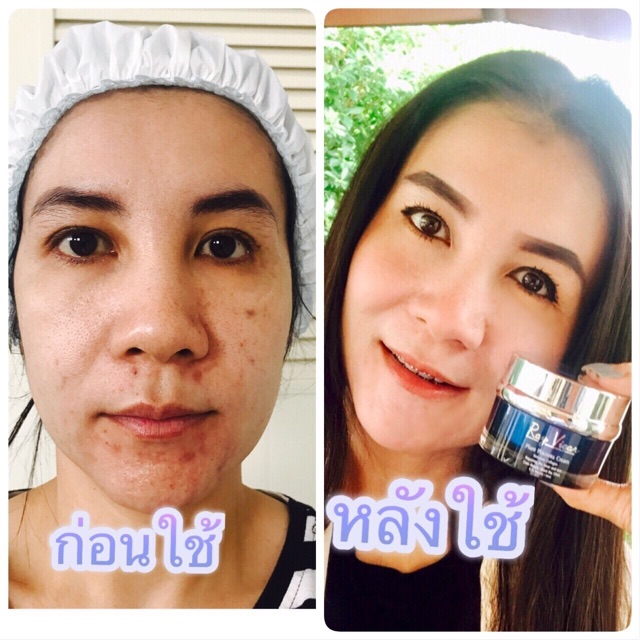 Ray Viear Plant Placenta Night Cream เรเวียร์ แพลนต์ พลาเซนต้า (ไนท์ ...