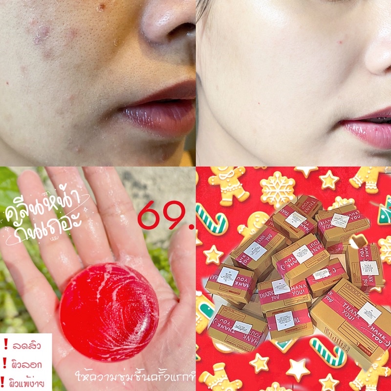 Manaskin official สบู่ลดสิว, ร้านค้าออนไลน์ | Shopee Thailand