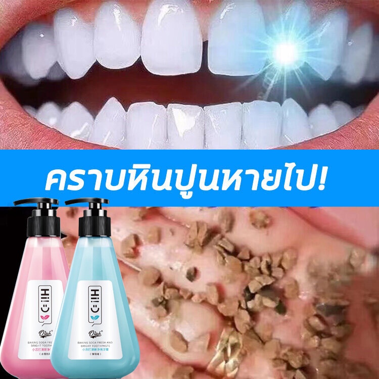 RONAR ยาสีฟันเบกกิ้งโซดา ยาสีฟันฟันขาว ลมหายใจสดชื่น ซ่อมฟันเหลือง ขจัด ...