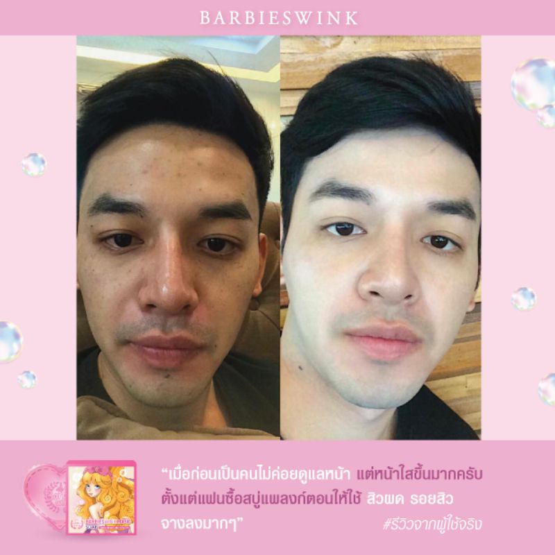 Barbieswink Mask Soap สบู่ล้างหน้าแพลงก์ตอน บาร์บี้วิ้งค์ สบู่มาสก์หน้า ลดสิว หน้าใส - the.one ...