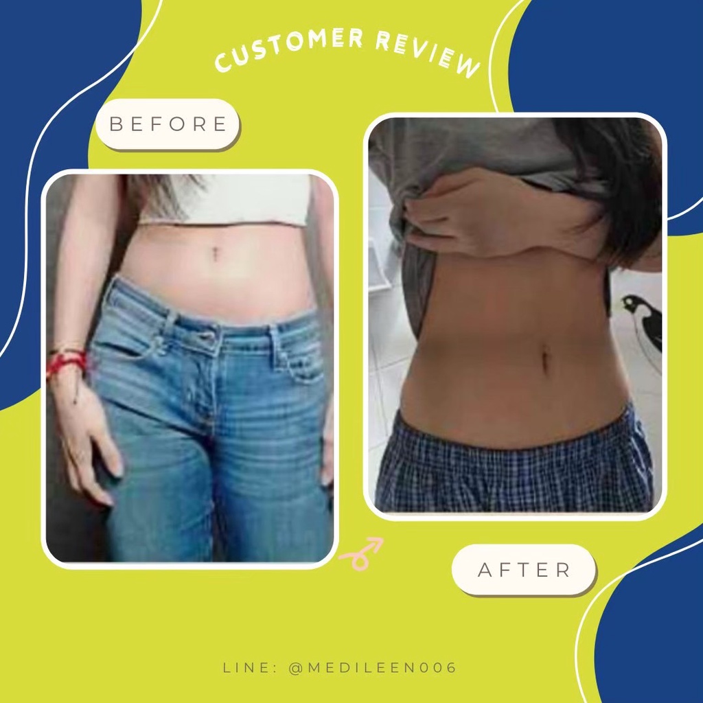 SET veronikaprerotic detox สะสมคะแนน ฟรีขวด - medileen_th - ThaiPick