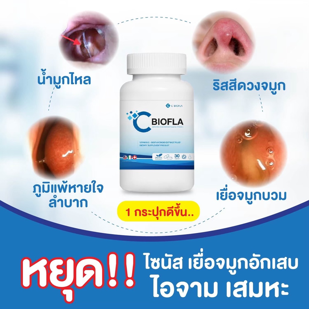ส่งฟรี 1แถม1 CBIOFLA ภูมิแพ้ ไซนัส ไมเกรน เสริมสร้างภูมิต้านทาน - shopstorezara - ThaiPick