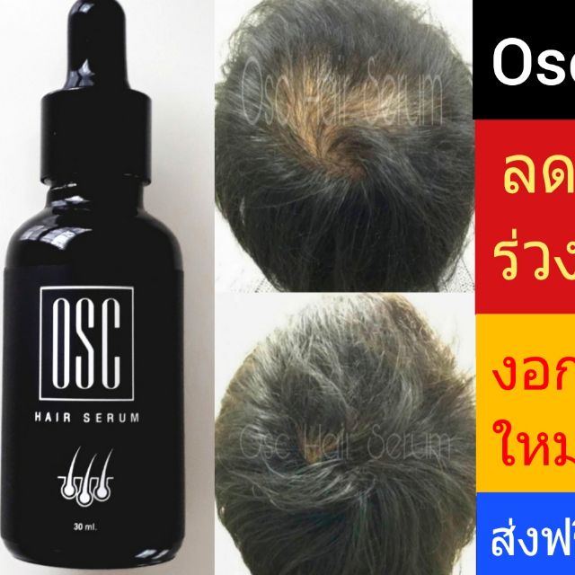 2ขวด Osc Hair Serum ปลูกผม แก้ผมหงอก เร่งผมยาว เพิ่มความดกดำเงางาม คืน ...