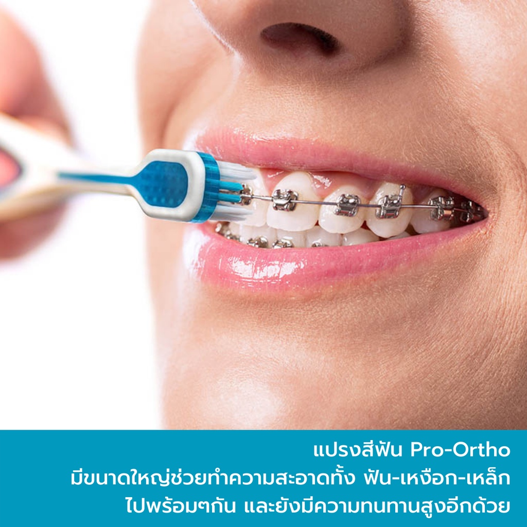 [สำหรับคนจัดฟัน] edel+white Pro-Ortho แปรงสีฟันสำหรับคนจัดฟัน - edel ...