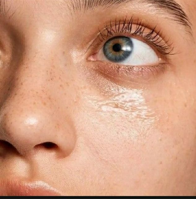 พร้อมส่ง Versed The Fix Emergency Eye Mask 30ml มาดามเกรียนแนะนำ ...