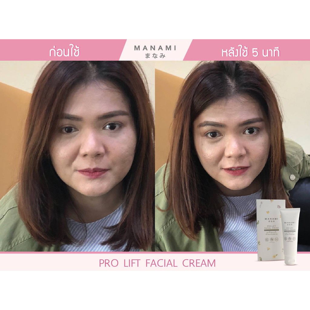 MANAMI PRO LIFT FACIAL CREAM ครีมทาหน้าเรียว ลดไขมันบนใบหน้า ยกกระชับ ...