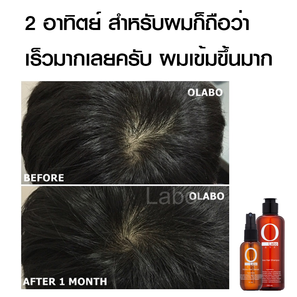 pip Minox 5 เร่งรากผมให้หนา ดกดำ 100เม็ด - poprock789 - ThaiPick