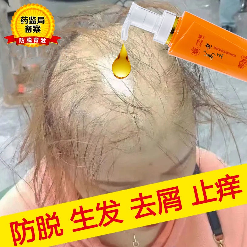 ป้องกันผมร่วง ปลูกผม ผู้ชายและผู้หญิง for ↂแชมพูขิงแก่ขิงแท้จาก Nine ...