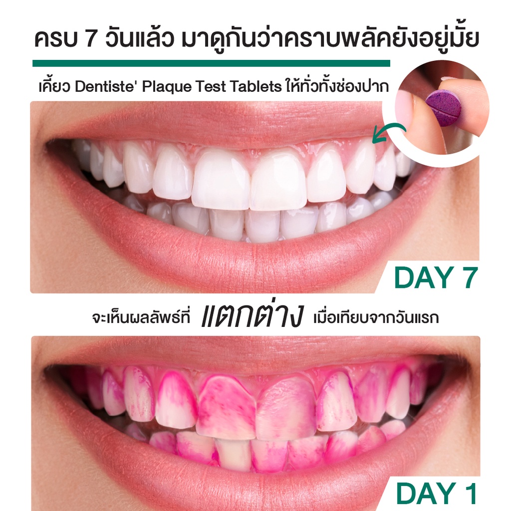 (แพ็ค 6) Dentiste' Plaque Test เดนทิสเต้ เม็ดม่วง สำหรับเคี้ยว ทดสอบ ...