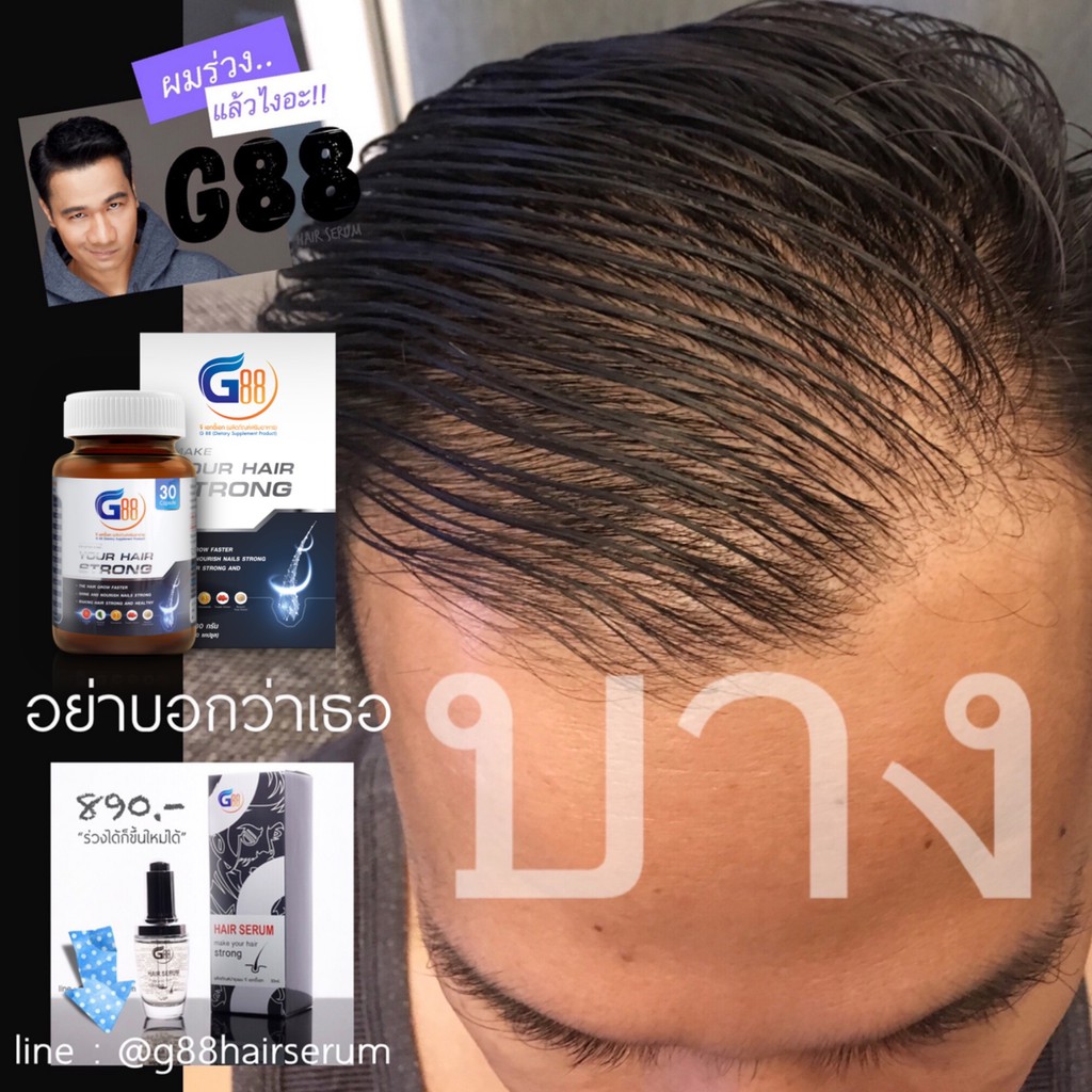 g88 hair serum + cushion / hair serum 1ขวด ครีมกันแดด 1ขวด - g88_official - ThaiPick