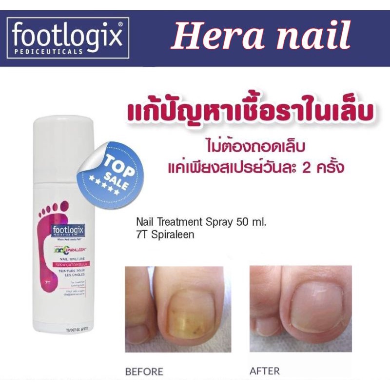 สเปรย์รักษาและป้องกันเชื้อรา50ml Footlogix Nail Tincture Anti ...