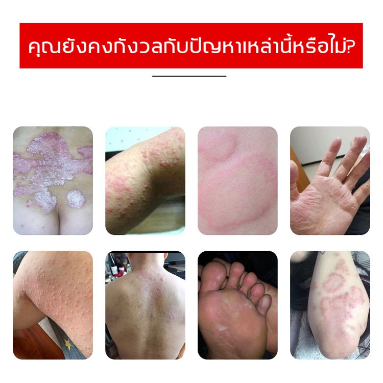 Sonaderm ถูกที่สุด พร้อมโปรโมชั่น - ธ.ค. 2021 | BigGo เช็คราคาง่ายๆ