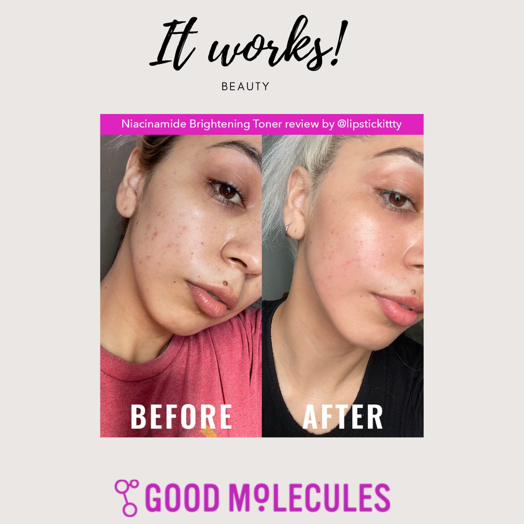IT WORKS! Good Molecules Niacinamide Brightening Toner [พร้อมส่ง ...