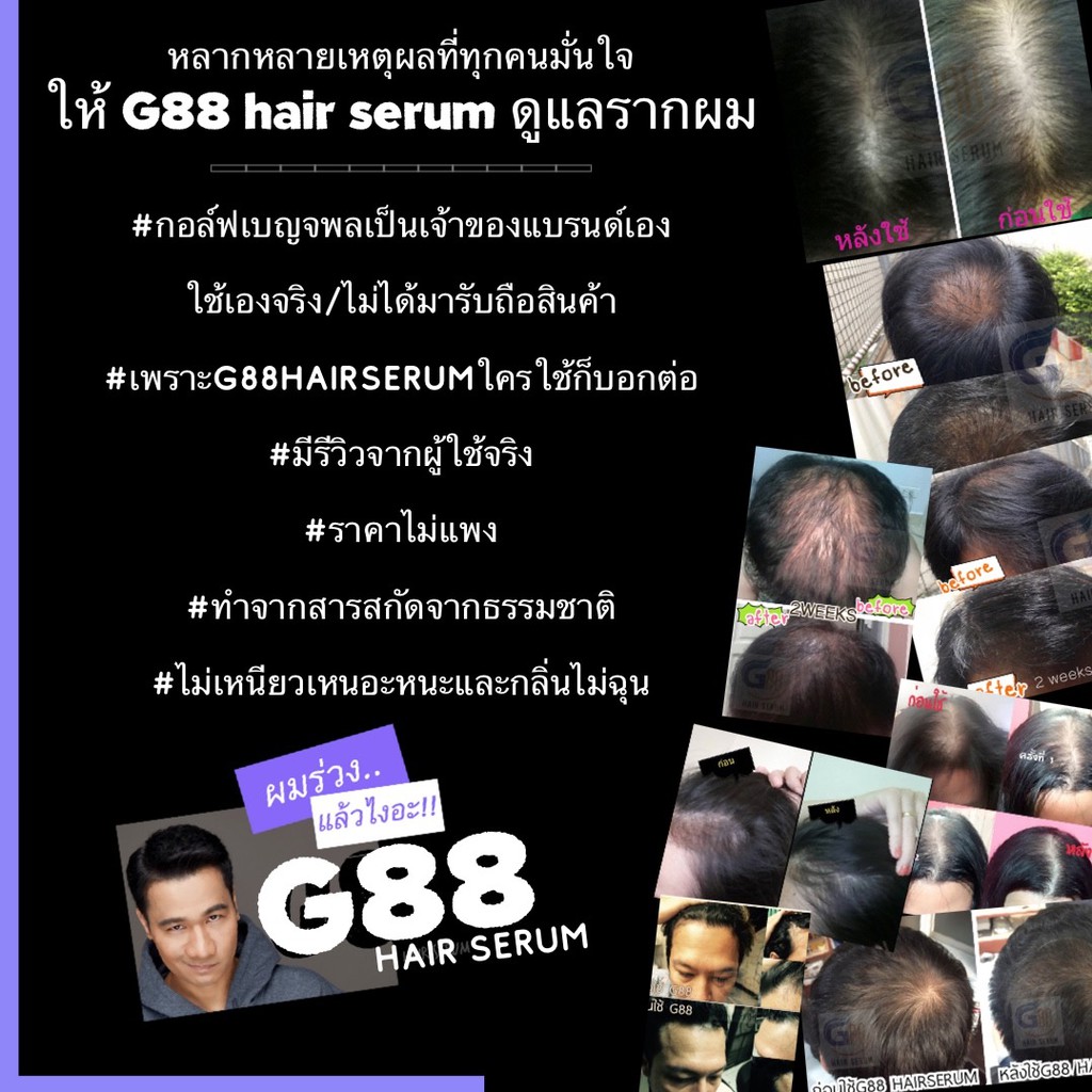 g88 hair serum special pack3 / hair serum1ขวด อาหารเสริม1กล่อง - g88_official - ThaiPick