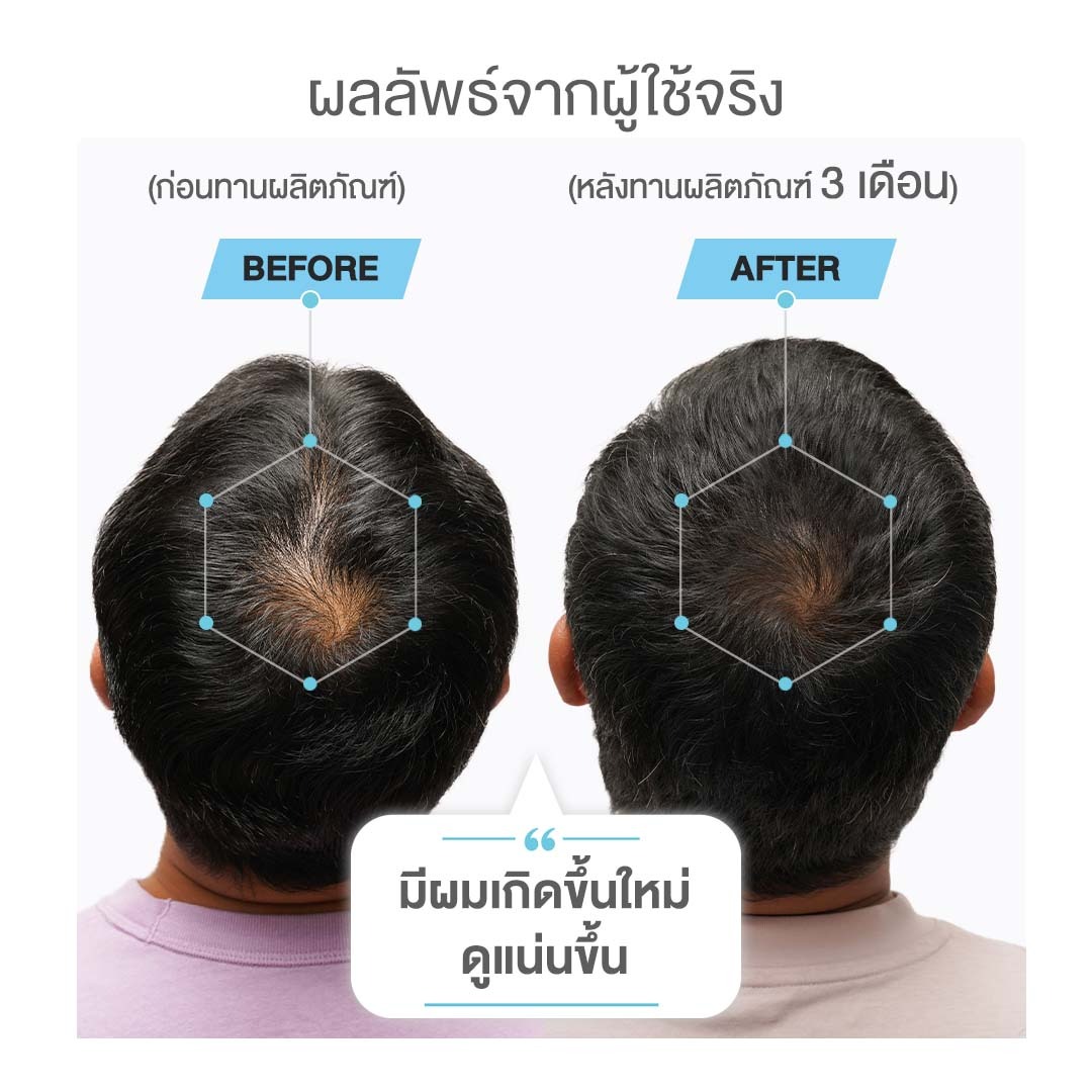 สั่งซื้อสินค้าออนไลน์จาก Bevita official store | Shopee Thailand