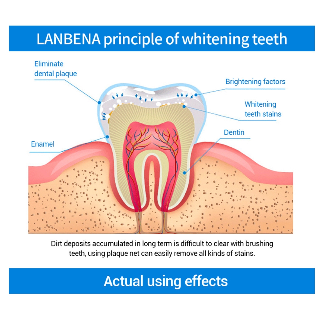 Teeth Whitening Oral Hygiene Cleaning Oral Teeth Care Tooth Cleaning ...