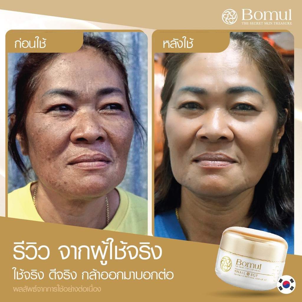 ขายดีมาก แนะนำ Bomul Snail Cream+EGF ครีมโบมุล ครีมบำรุงผิว ช่วยให้ฝ้า ...