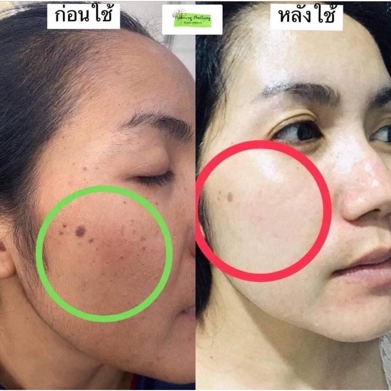 แท้มีปลายทางชุดทดลอง Rosetta รับตรงจากบริษัท - anyi.skin - ThaiPick